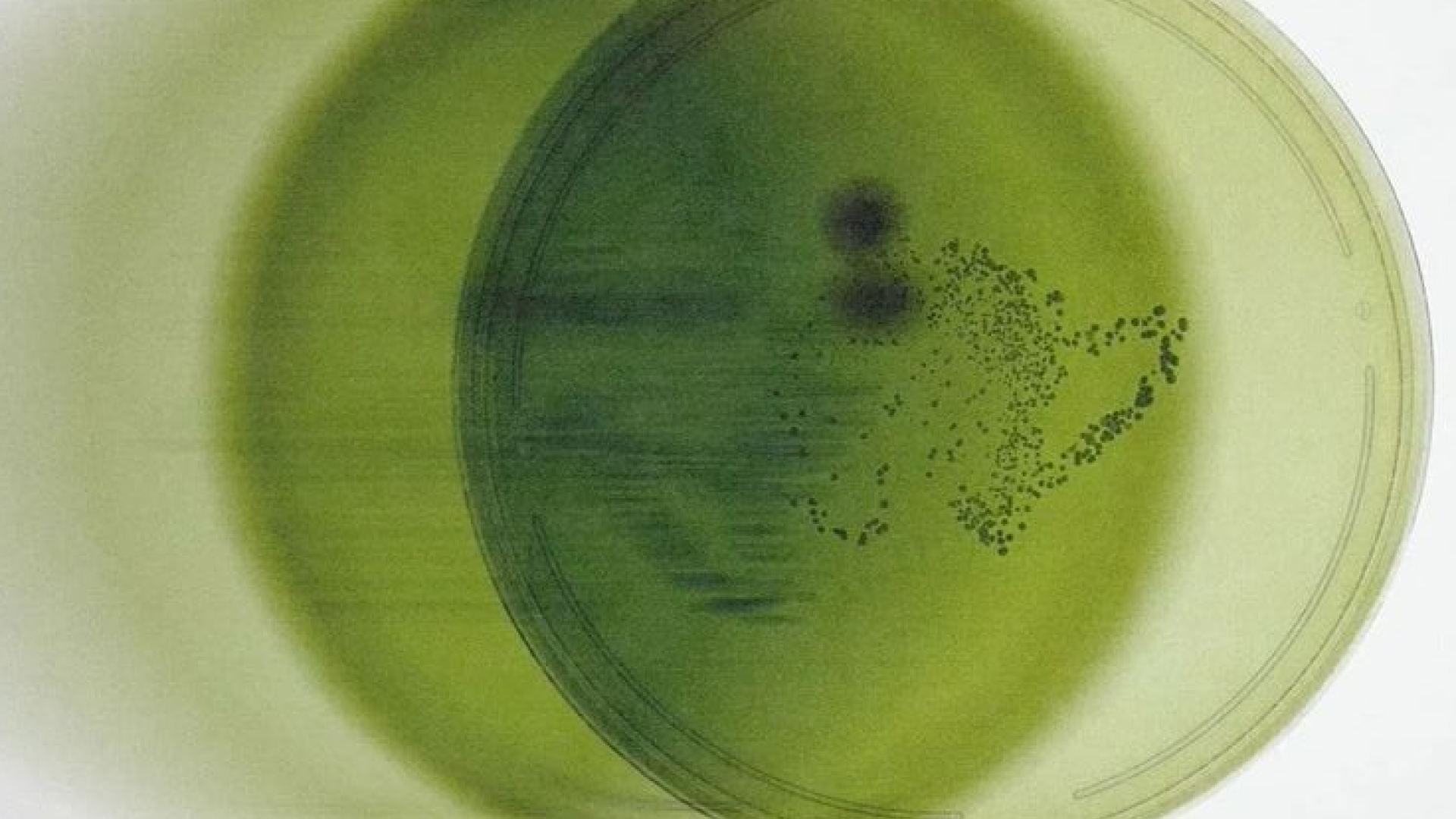 Average Antral Follicle Count by Age: What Your Numbers Really Mean