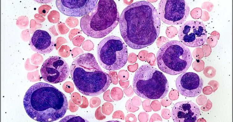 Understanding Oophoritis: Causes, Symptoms, and Treatment