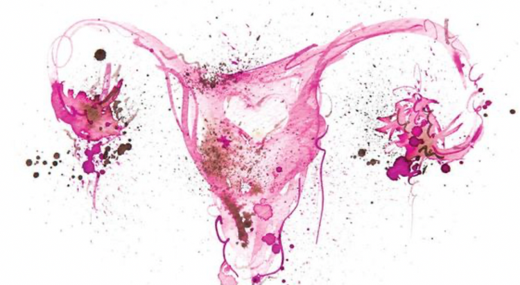Bulky Uterus with Thickened Endometrium : Causes and Treatment – Arva ...