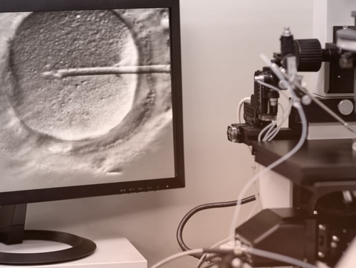 Day by Day Guide After IUI: Symptoms After IUI