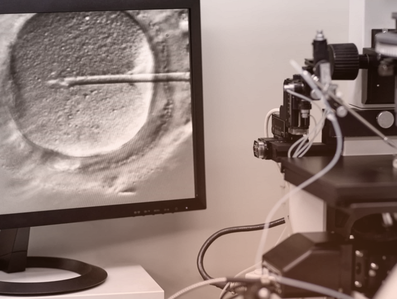 Understanding the IUI Procedure: A Step-by-Step Guide